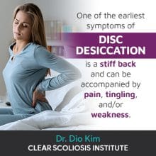 What Is Disc Desiccation? What Causes It? How To Treat It