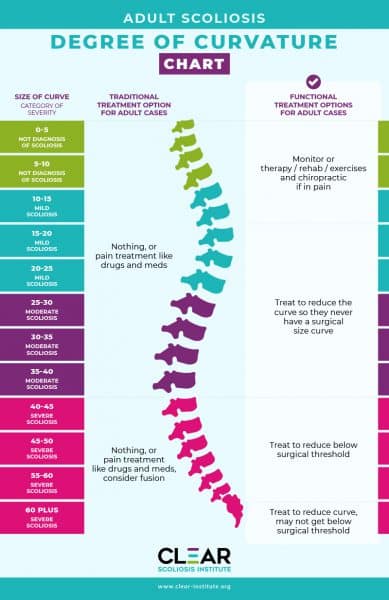 Adult Scoliosis Degrees of Curvature Chart [EXPLAINED]