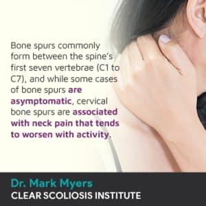What Are Bone Spurs In Neck? Can They Be Treated?