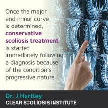 S-Shaped Scoliosis: What Is It? Does It Need Treatment?