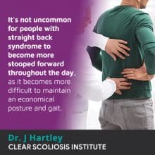 What Is Straight Back Syndrome? Can It Be Treated?