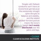 How Flat Back Syndrome Affects You and Treatment Options