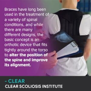 Kyphosis Brace: Types, Benefits, and How They Work