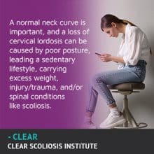 Understanding Loss of Cervical Lordosis: Causes and Effects